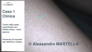 Xerosi cutanea (pelle secca) e prurito: la guida completa | Myskin