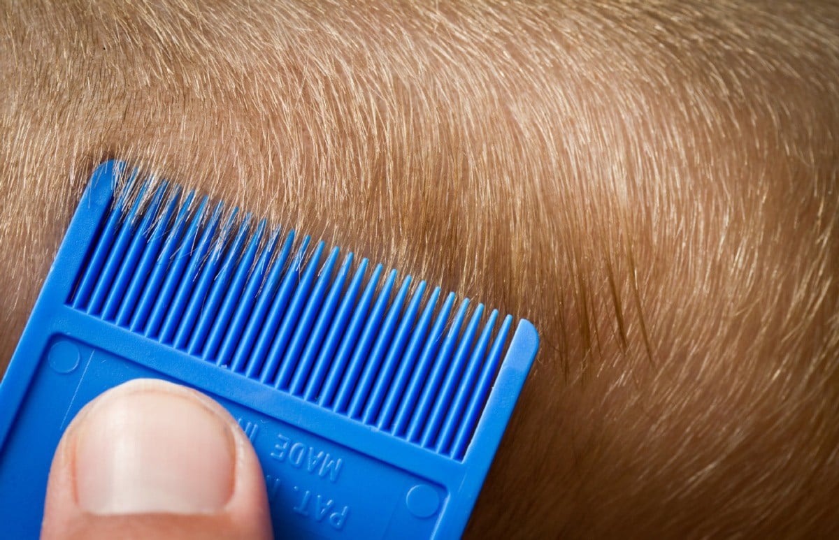 Come eliminare i pidocchi: la pediculosi cosa fare | Myskin