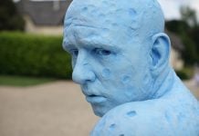 Bolle dopo l'azoto liquido per le verruche. Cosa fare? | Myskin ...